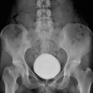 La radiologie avec produit de contraste - Radiologie du Vignoble